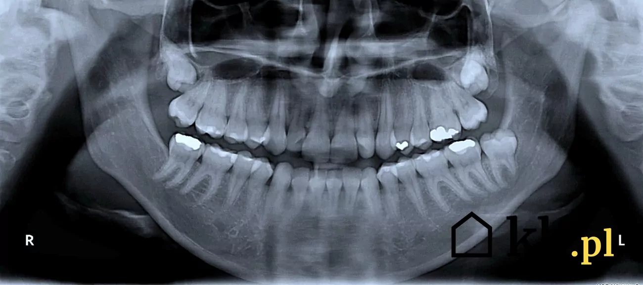 Cennik rtg zęba 2026 w ponad 300 miastach